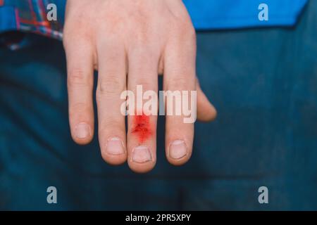 hand injury with blood, blood wound cut top view, copy space, medical ...