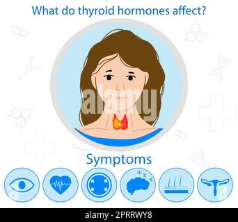 Illustration of thyroid gland and symptoms of hypothyroidism. Medical ...