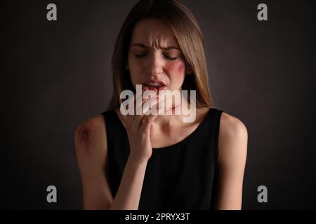 Woman with facial injuries on black background. Domestic violence ...