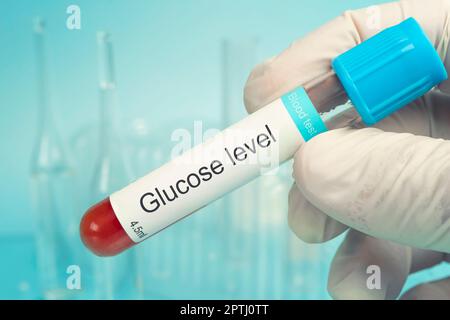 Hematology A1C blood level diabetes report with gold cap blood sample ...