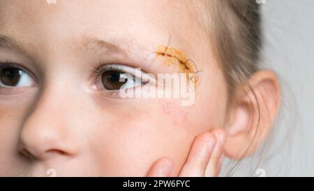 Close up sad, drear cropped cute girl face with stitches on scratch of ...