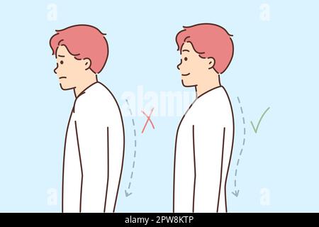 Standing man with incorrect spine posture. Spine health, bad body pose ...