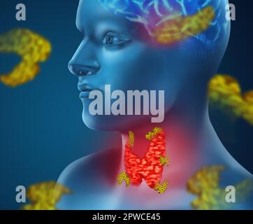Illustration of human with inflamed thyroid gland on color background ...