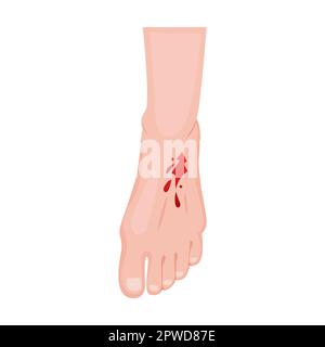 Open cut wounds knee elbow bruises foot injury treatments concept round ...