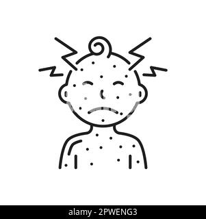 Baby boy with skin rash, hives, irritation or chickenpox measles ...