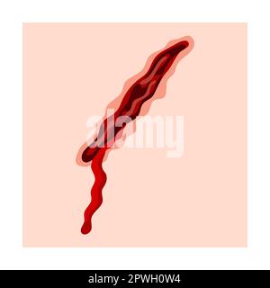 Scar with stitches cartoon illustration. Bloody wound, injures ...