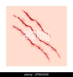 Scar cartoon illustration. Injures, scratches, bruises, surgical ...