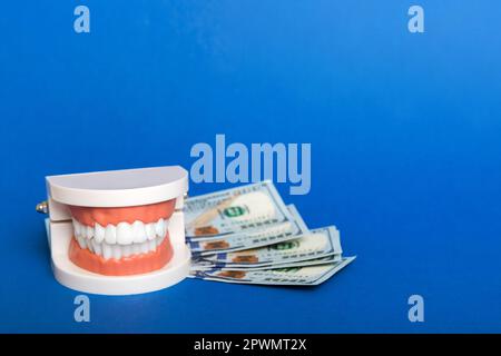 Model of oral cavity with teeth and dollar banknotes on light blue ...