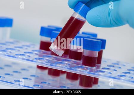 handling blood in a laboratory with a pipet Stock Photo - Alamy