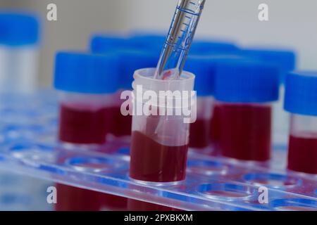 handling blood in a laboratory with a pipet Stock Photo - Alamy