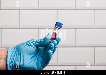 a hand in blue gloves i shandling a blood probe in a laboratory room ...
