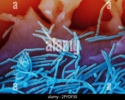 Colorized electron microscope image of yellow fever virus ...