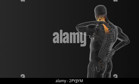 Cervical vertebral pain medical animation Stock Photo - Alamy