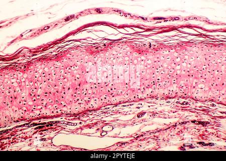 Elastic cartilage of human outer ear, light micrograph Stock Photo - Alamy
