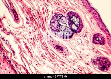 Connective tissue located at human outer ear, light micrograph ...