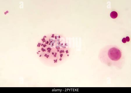Female chromosomes inside the cell, light photomicrograph Stock Photo ...