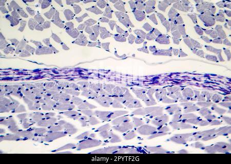 Human skeletal muscle, cross section, light micrograph Stock Photo - Alamy