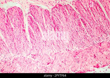 Light micrograph of a cross-section of a human fallopian tube. The ...
