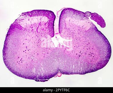 Spinal cord. Light micrograph of a cross-section through the spinal ...