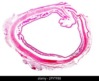 Light micrograph of a cross-section of the trachea, showing C-shaped ...