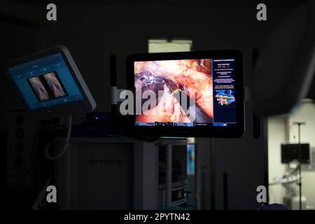 Modern hybrid surgery, 3D innovative technology with the DaVinci system ...