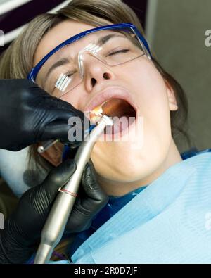 Treatment of caries chewing lateral tooth of the upper jaw. Sanitation ...