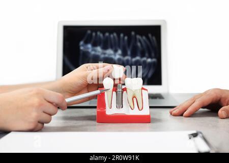 Doctor showing patient educational model of dental implant in clinic ...