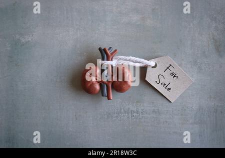 Human kidney with tag FOR SALE. Organ trafficking, organ transplant and ...