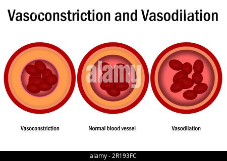 Comparison of normal, vasoconstriction and vasodilation blood vessels ...