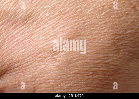 Closeup view of dry human skin as background Stock Photo - Alamy