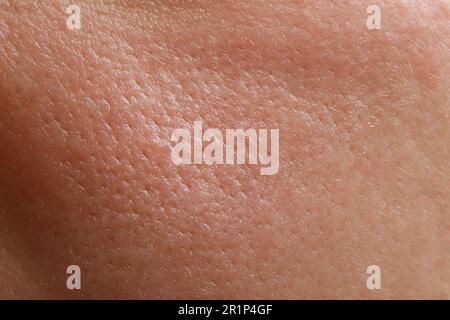 Closeup view of human oily skin as background Stock Photo - Alamy