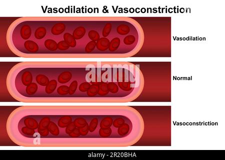 vasoconstriction and vasodilation blood pressure, dilated blood vessels or capillaries or artery ...