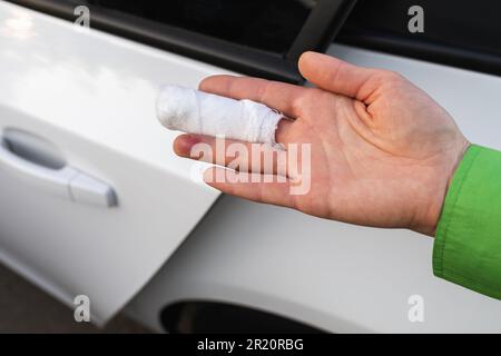 Man hand or finger pinched by the car door; close up portrait of finger ...