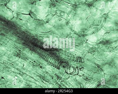 Squash cells texture seen in biological optical microscope. Stained for ...