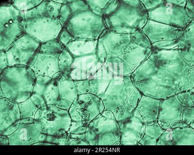 Squash cells texture seen in biological optical microscope. Stained for ...