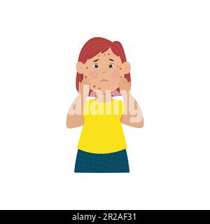 Allergy and infectious rashes on the face in children Vector ...