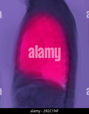 Chest X-ray or X-Ray Image of Human Lung Lateral View with full ...