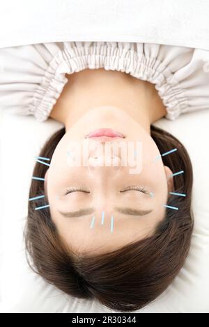 Up of a woman getting acupuncture on her face at an acupuncture clinic ...