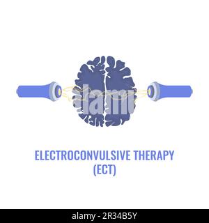 ECT electroconvulsive therapy for severe depression treatment Stock ...