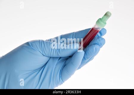 Laboratory test form and blood samples on table Stock Photo - Alamy