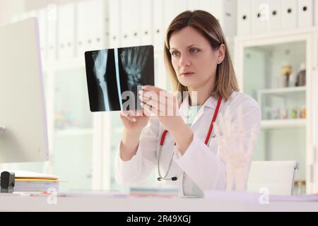 Doctor studies X-ray picture of patient arm sitting at desk Stock Photo ...