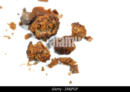 Nephrolithiasis, irregular brown kidney stones (renal calculus or ...