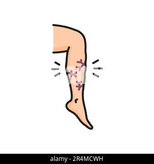 Venous disease edema color line line icon. Vector varicose vein and ...