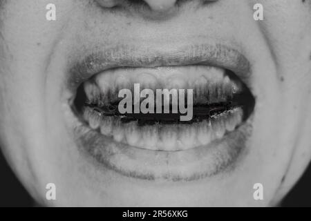 Open mouth of a girl with a lit cigarette instead of teeth black and ...