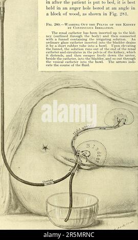 "Operative gynecology :" (1906 Stock Photo - Alamy