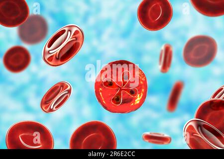 Babesia parasites inside red blood cell, computer illustration. This is ...