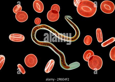 Wuchereria bancrofti. Computer illustration of the microfilaria larval ...