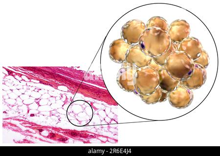 Fat cells, light micrograph and computer illustration. White adipose ...
