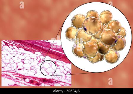 Fat cells, light micrograph and computer illustration. White adipose ...