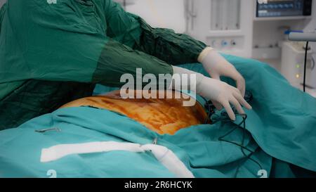 Obesity surgery. Woman preparing for obesity surgery. Before the ...